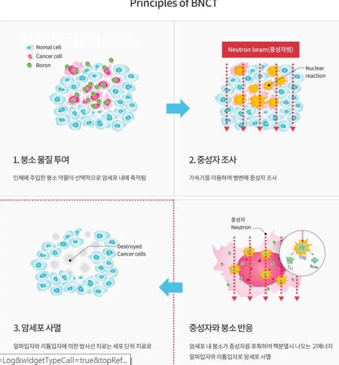 차세대 암 치료기인 붕성 중성자 포획치료(BNCT)